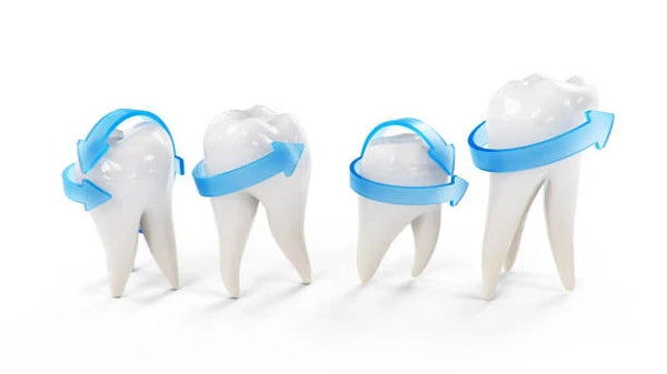 😬 Teeth Shifting Back? How Retainers Prevent It - NewSmile AU