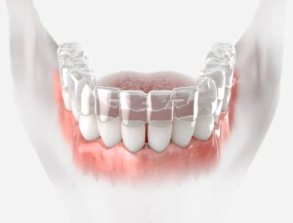 😁 Gap Teeth: Can Retainers Close Them? - NewSmile AU
